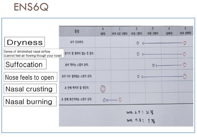 어? 이건 뭐지?- 사진으로 보는 이비인후 질환 > 뉴스 | 한의신문